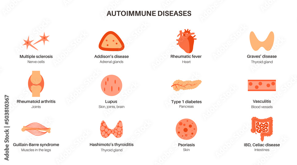 Autoimmune disorders diseases Stock Vector | Adobe Stock