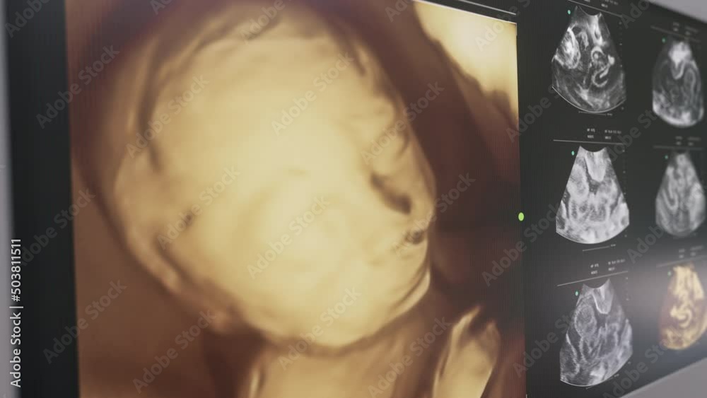 Showing a prenatal scan procedure on the monitoring device screen ...