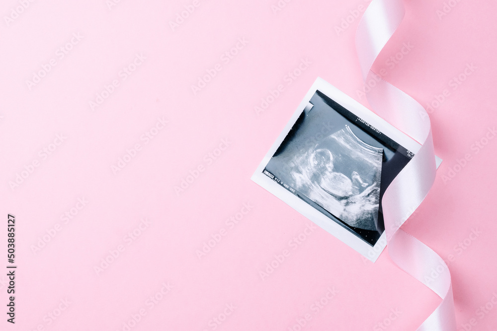 Ultrasound image pregnant baby photo. Fashion cute baby cloth with ...