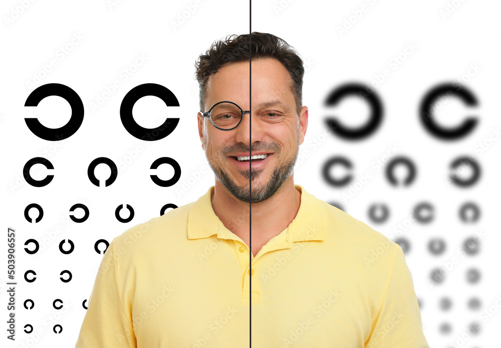 Collage with photos of man with and without glasses and eye charts on ...