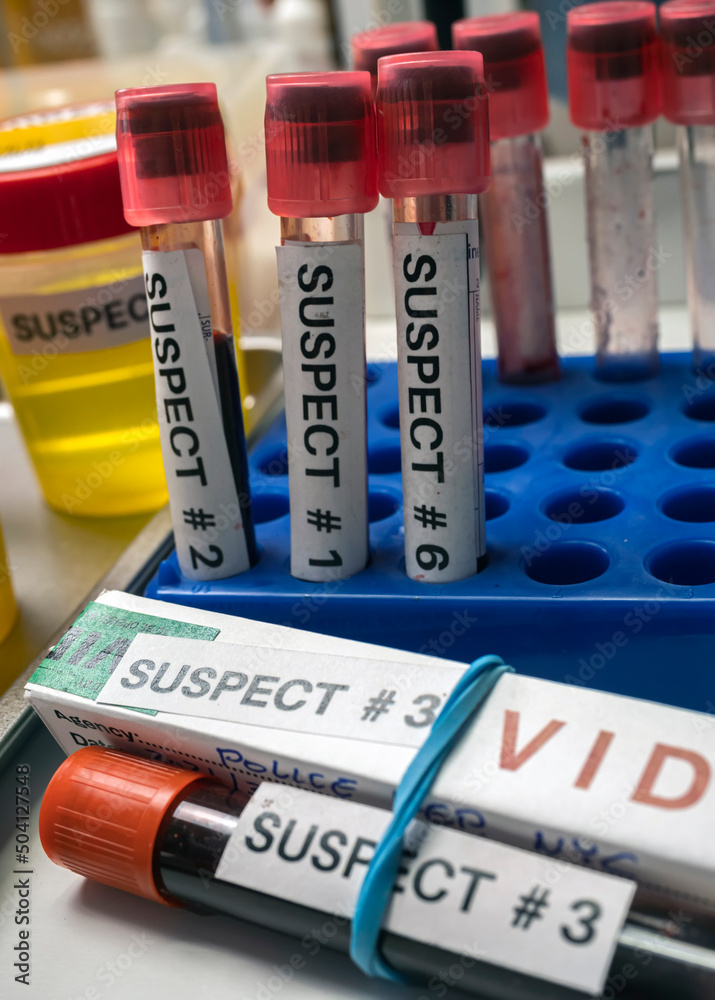 Various analyses of urine, saliva and blood of homicide suspects in ...