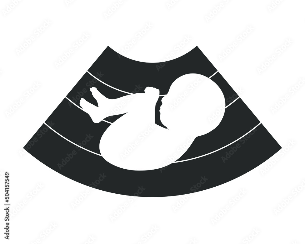Fetus ultrasound graphic icon. Symbol ultrasound examination pregnancy ...
