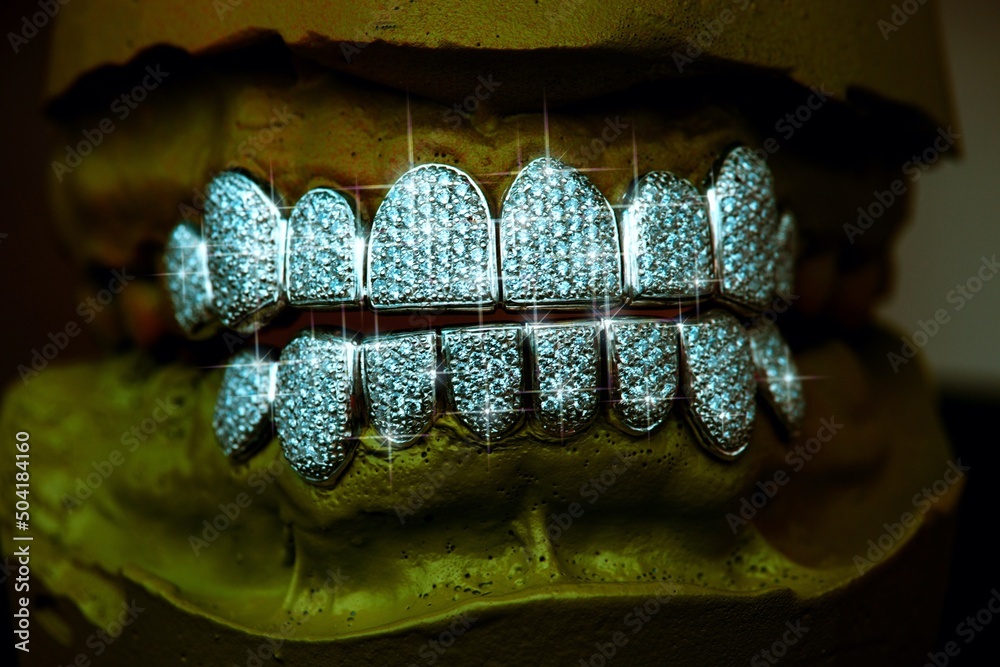 Grillz - Dental Jewelry Stock Photo | Adobe Stock