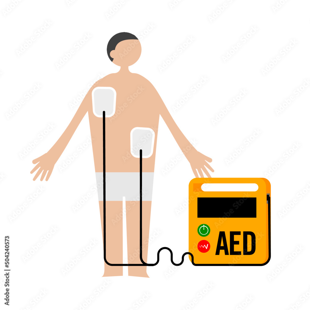 Cartoon character for basic life support, an AED pads apply on human ...