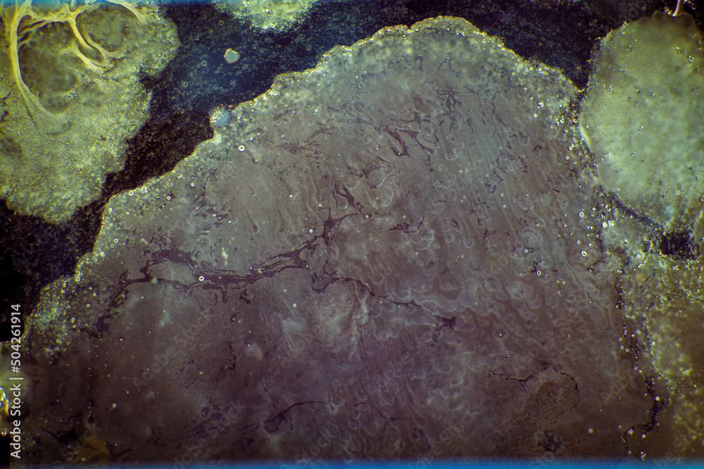 Fungal growth on biological material microscopic image Stock Photo ...