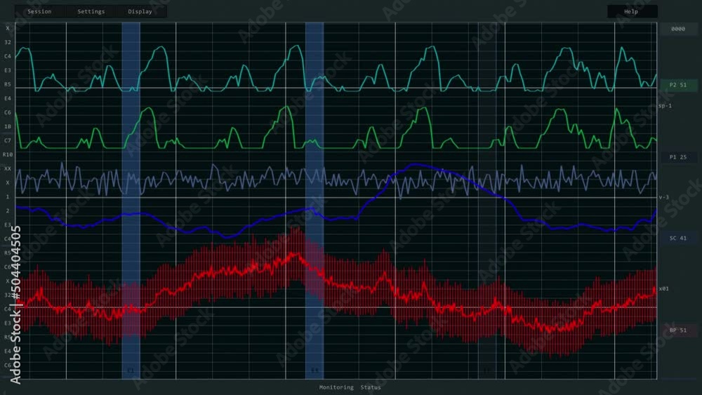 Technical Monitoring Diagram with Graphs and Analytical Industrial ...