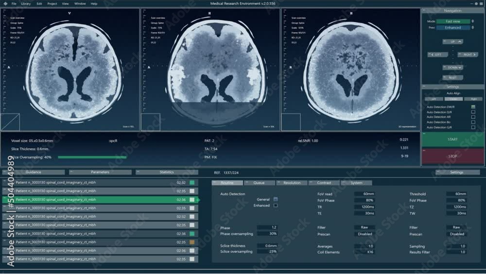 Magnetic Resonance Imaging Brain Scan Mock-up with Multiple Windows and ...