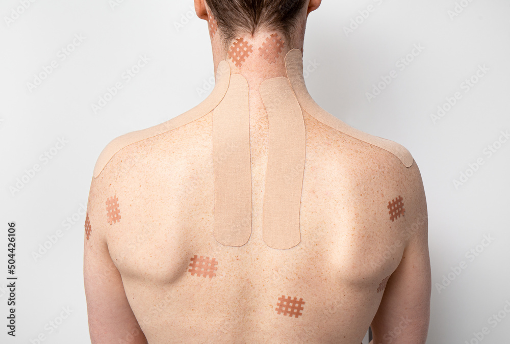 Close up view of man back and neck with various pain relief batches ...