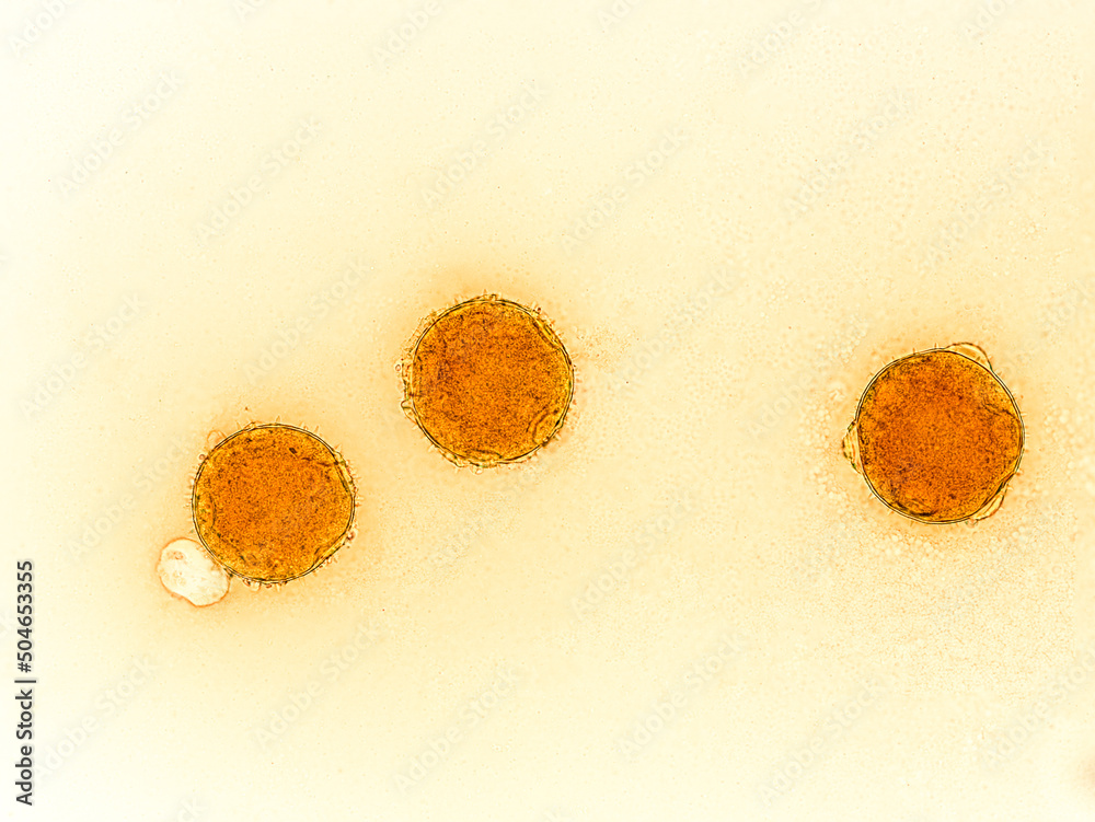 cucurbita pepo pollen grains under the microscope - optical microscope ...