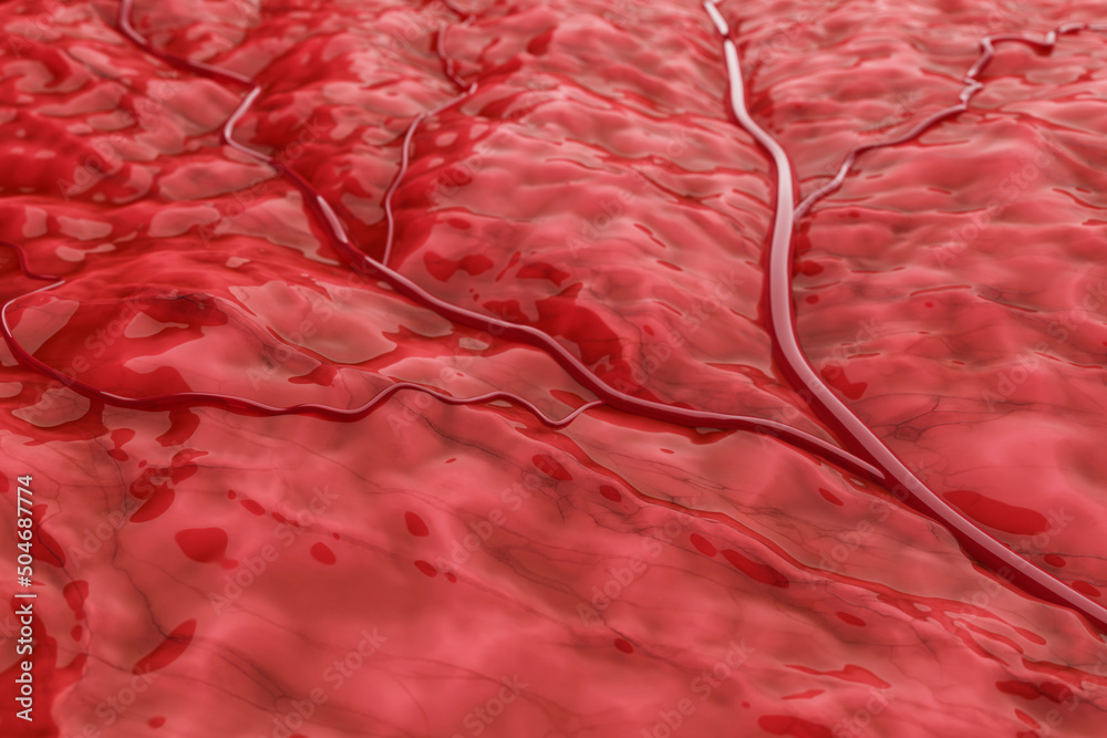Illustrazione Stock neurology dementia and condition capillaries ...