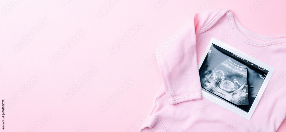 Ultrasound image pregnant baby photo. Fashion cute baby cloth with ...