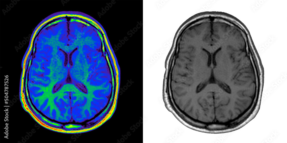 Brain scan. Brain mri. Brain blue. Brain Magnetic resonance scans. blue ...
