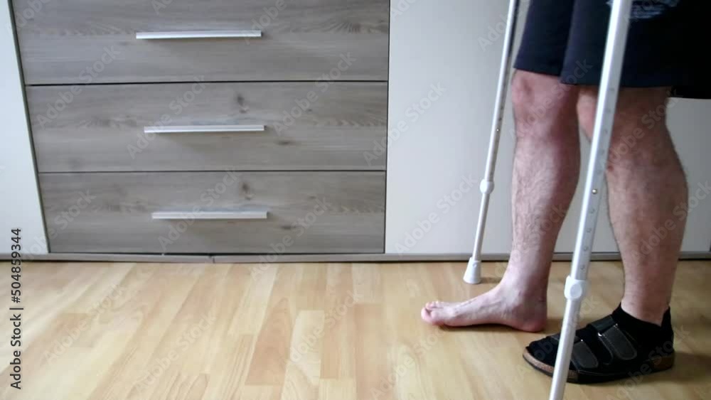 European man first steps after Achilles tendon rupture operation shows ...