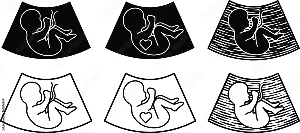 Baby Sonogram Diagram Clipart Set - Outline and Silhouette Stock Vector ...