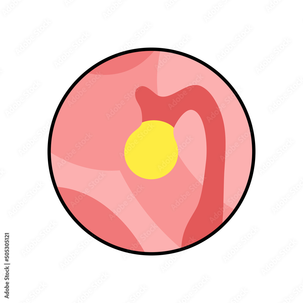 Pineal gland anatomy Stock Vector | Adobe Stock