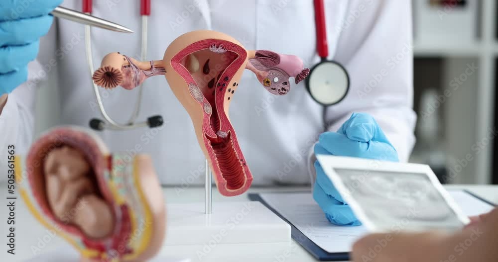 Doctor showing patient diseases of female reproductive system on ...