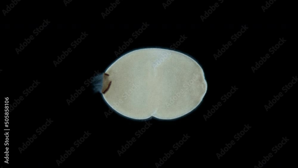 Larva sea sponge Parenchymella under microscope, Porifera Phylum ...