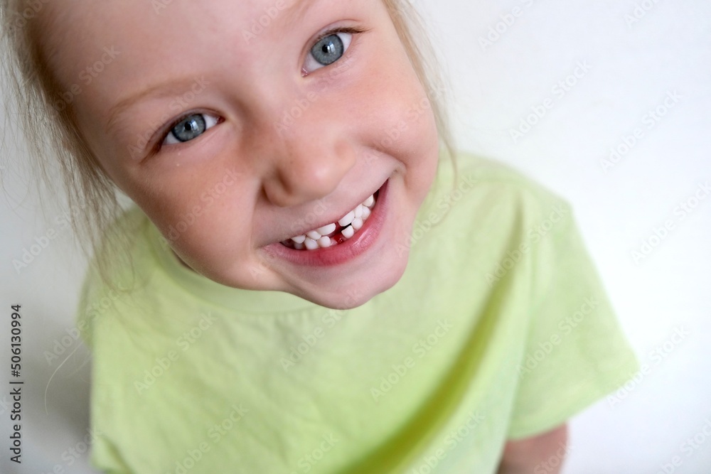 Portrait of a little girl with a wide smile without a milk front tooth ...
