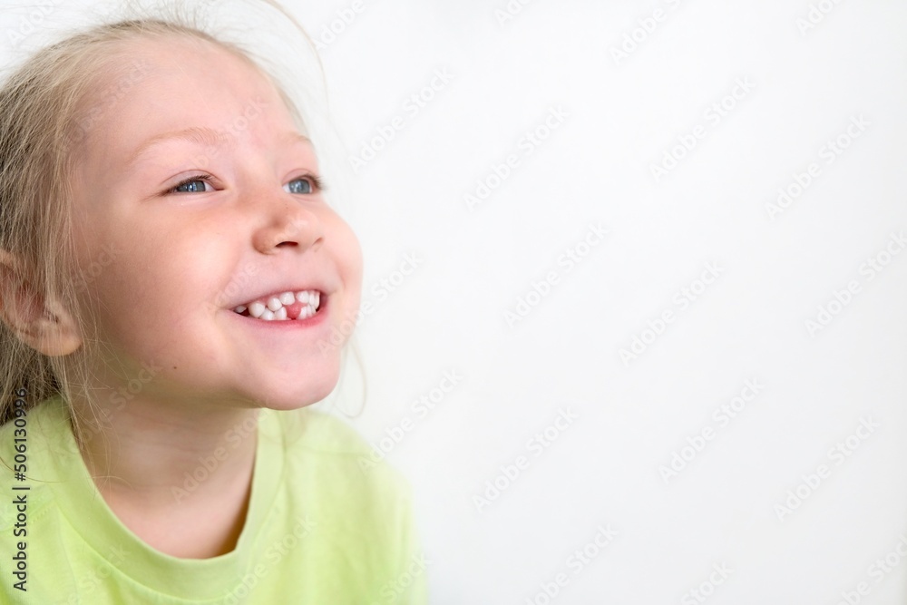 Portrait of a little girl with a wide smile without a milk front tooth ...