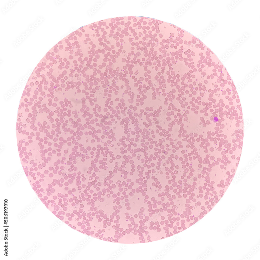Red blood cells in blood smear on white background. Stock Photo | Adobe ...