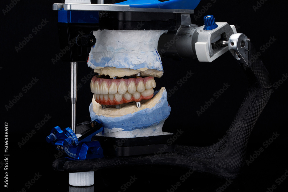 dental articulator with two prostheses in the bite, side view on a ...