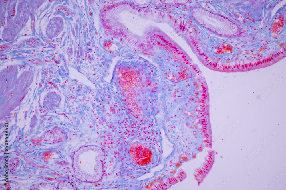 Columnar epithelium of human gall bladder under the microscope in Lab ...