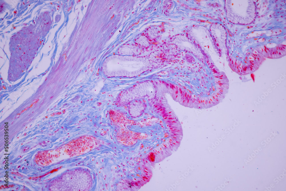 Columnar epithelium of human gall bladder under the microscope in Lab ...