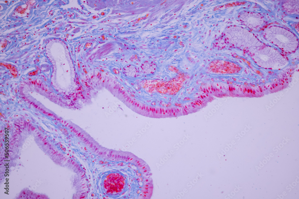 Columnar epithelium of human gall bladder under the microscope in Lab ...