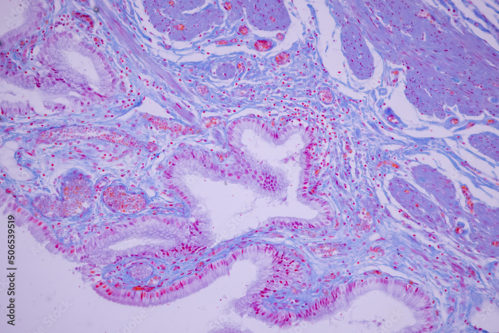 Columnar epithelium of human gall bladder under the microscope in Lab ...
