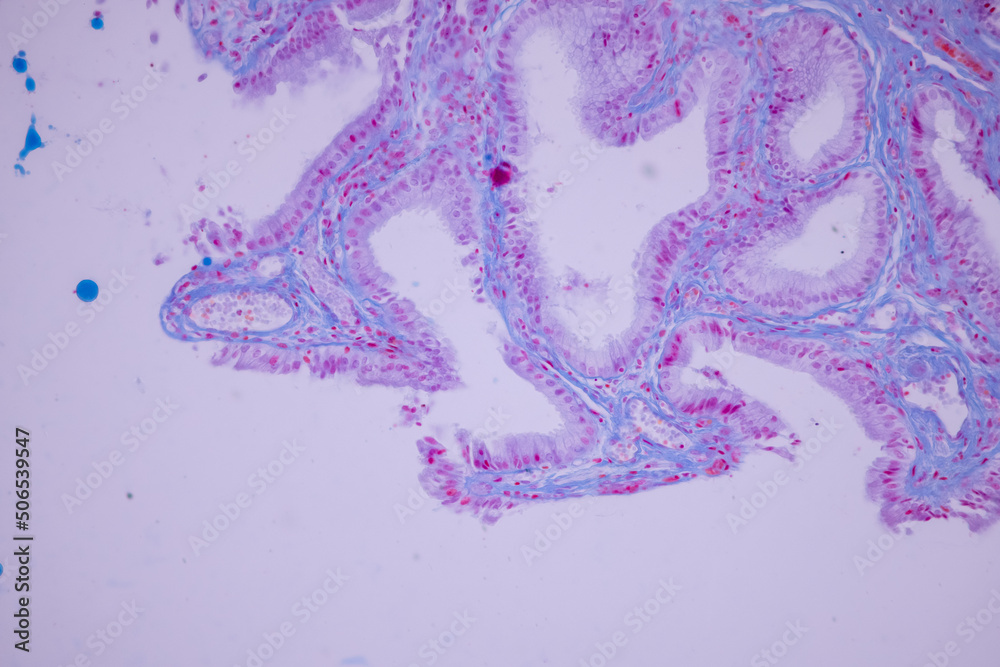 Columnar epithelium of human gall bladder under the microscope in Lab ...