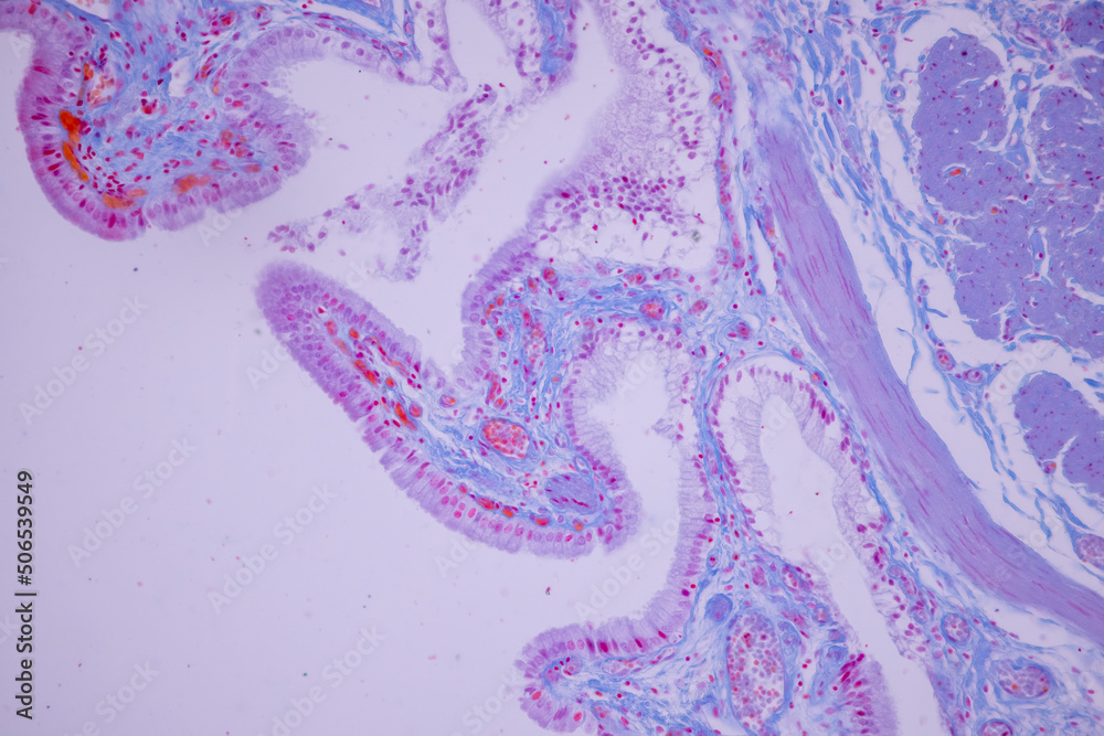 Columnar epithelium of human gall bladder under the microscope in Lab ...