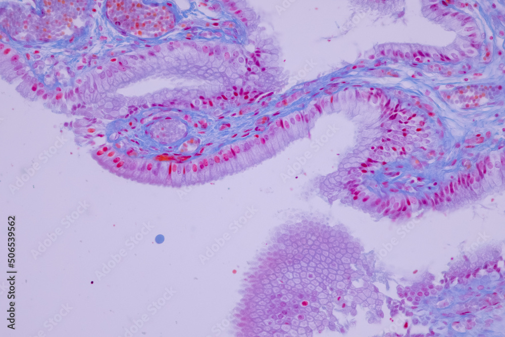 Columnar epithelium of human gall bladder under the microscope in Lab ...