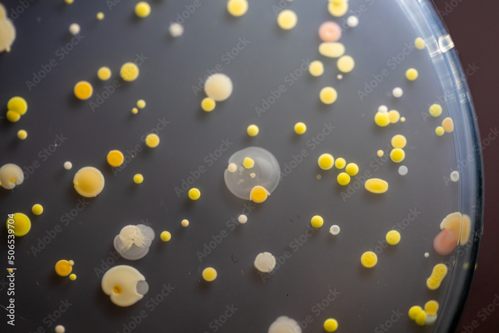 Backgrounds of Characteristics and Different shaped Colony of Bacteria ...