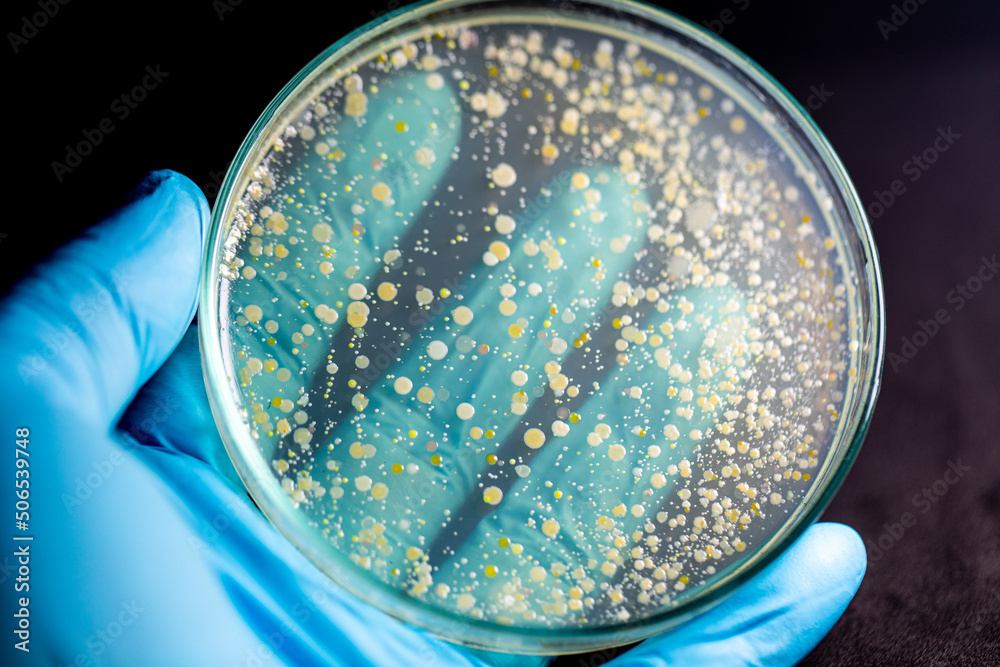 Backgrounds of Characteristics and Different shaped Colony of Bacteria ...