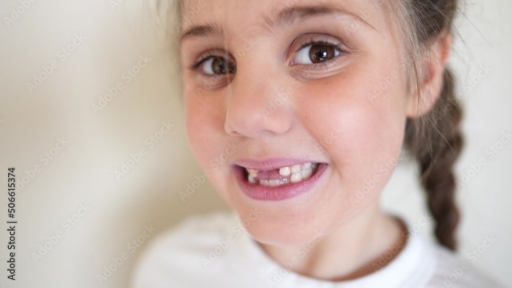 baby no teeth. child smiling no milk a teeth fell out. medicine ...