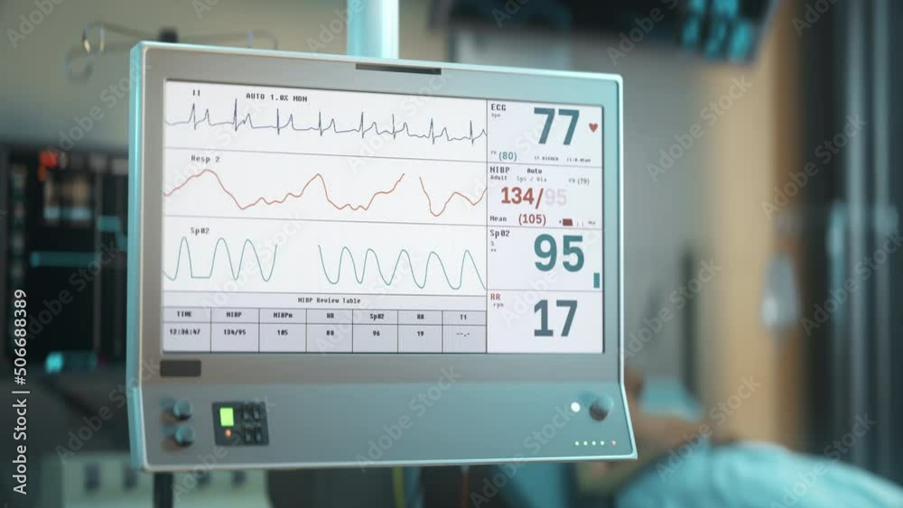 Cardiology device is showing a detailed graph of the patients pulse ...