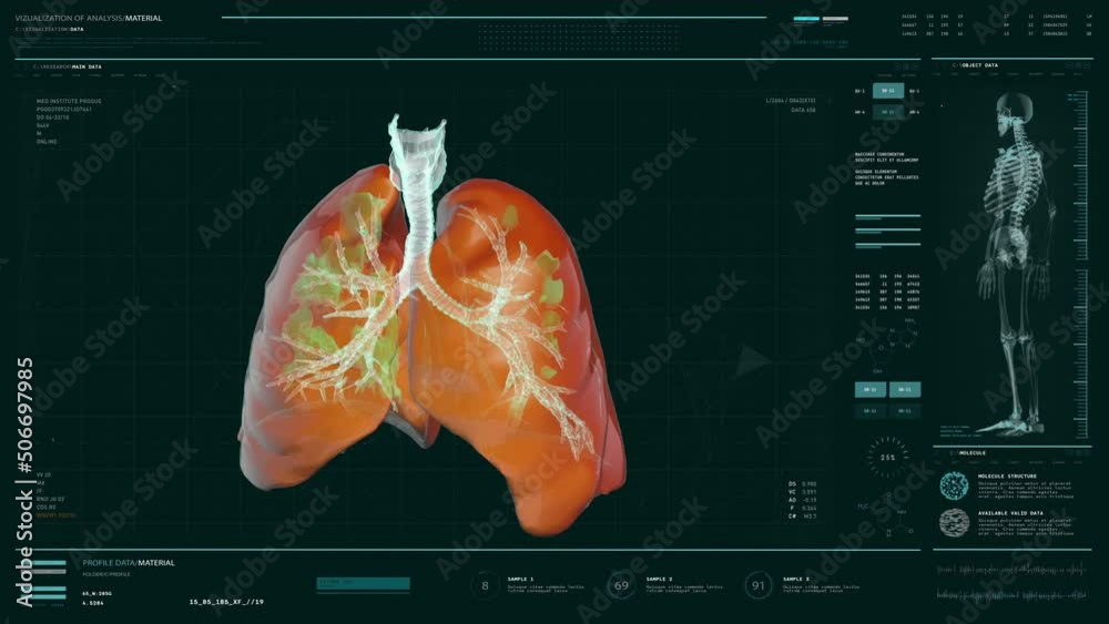 Medical Computer Scan For Patients Therapy Analyzing Respiratory System ...