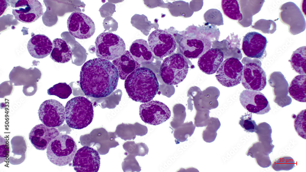 Foto de Photomicrographs of granulocytopoiesis: myeloblast ...