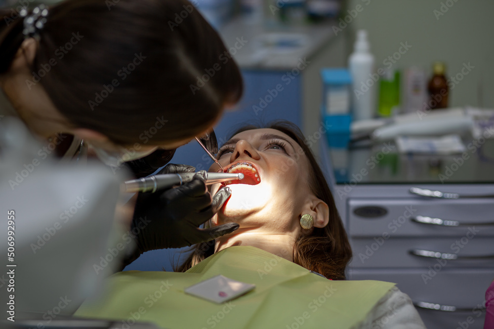The process of removing braces.Beautiful woman in dental chair during ...