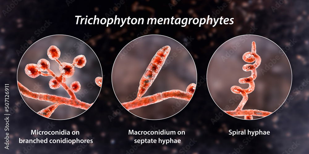 Fungi Trichophyton mentagrophytes, 3D illustration Stock Illustration ...