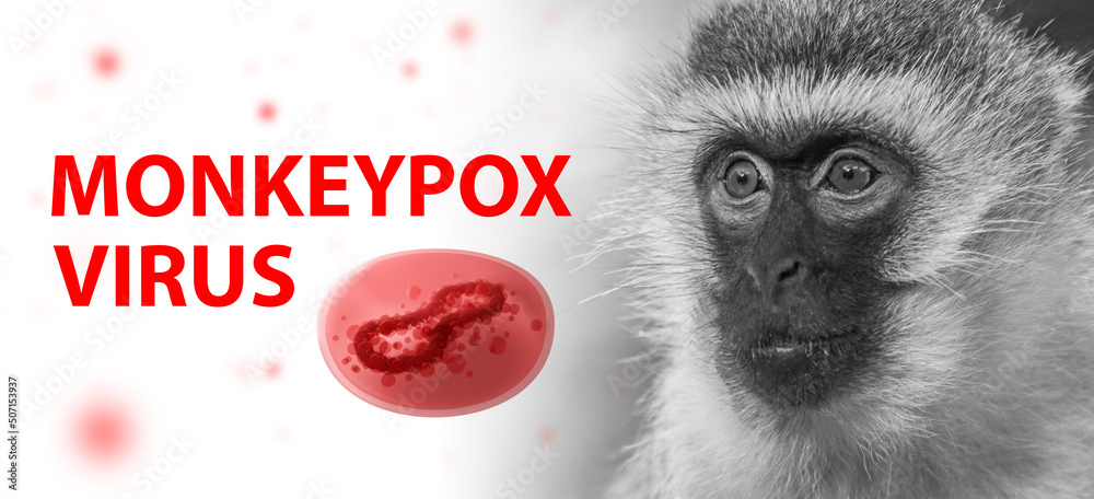 Monkeypox outbreak concept. Monkeypox is a viral zoonotic disease ...