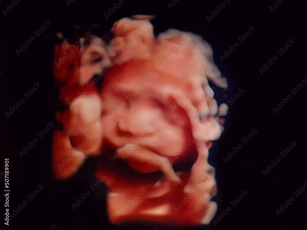 fetal baby ultrasound picture Stock Photo | Adobe Stock