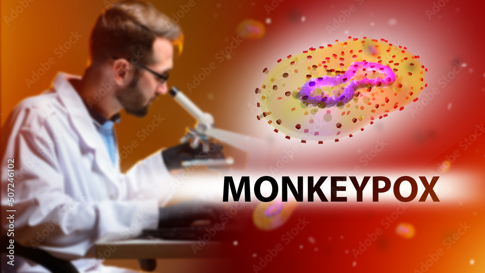 Doctor is studying monkeypox. Laboratory study of monkeypox bacteria ...
