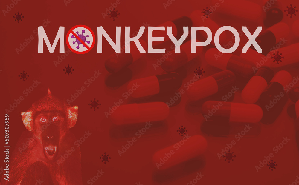 Monkeypox outbreak concept. Monkeypox is caused by monkeypox virus ...