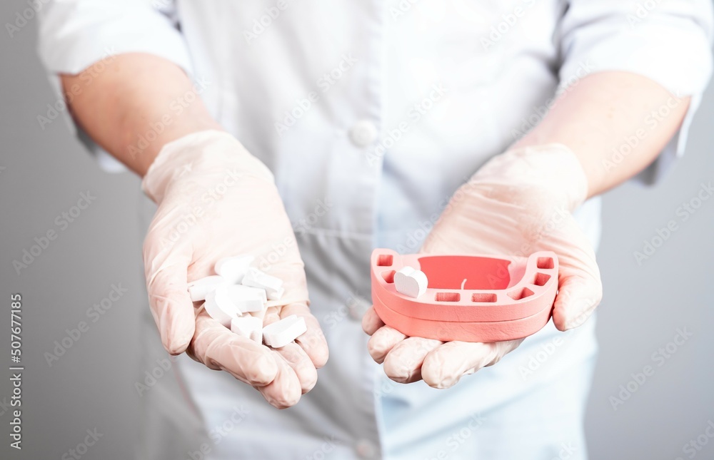 Dentist showing jaw model with single tooth and fallen teeth in hand to ...