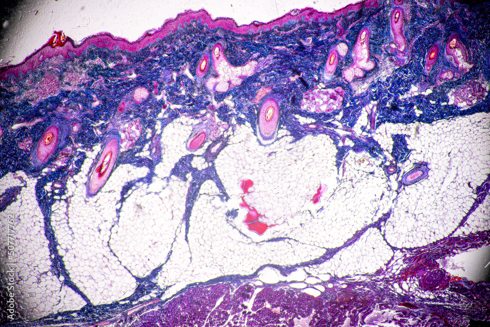 Scalp and hair follicles of human under the microscope in Lab. Stock ...