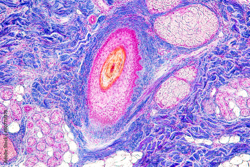 Scalp and hair follicles of human under the microscope in Lab. Stock ...