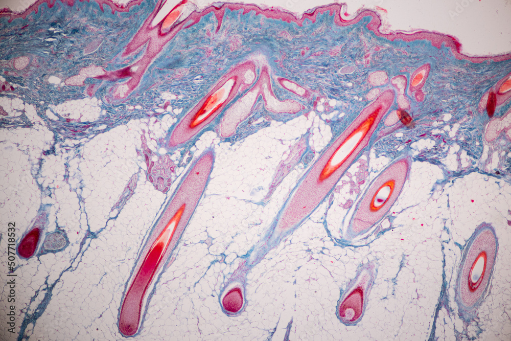 Scalp and hair follicles of human under the microscope in Lab. Stock ...