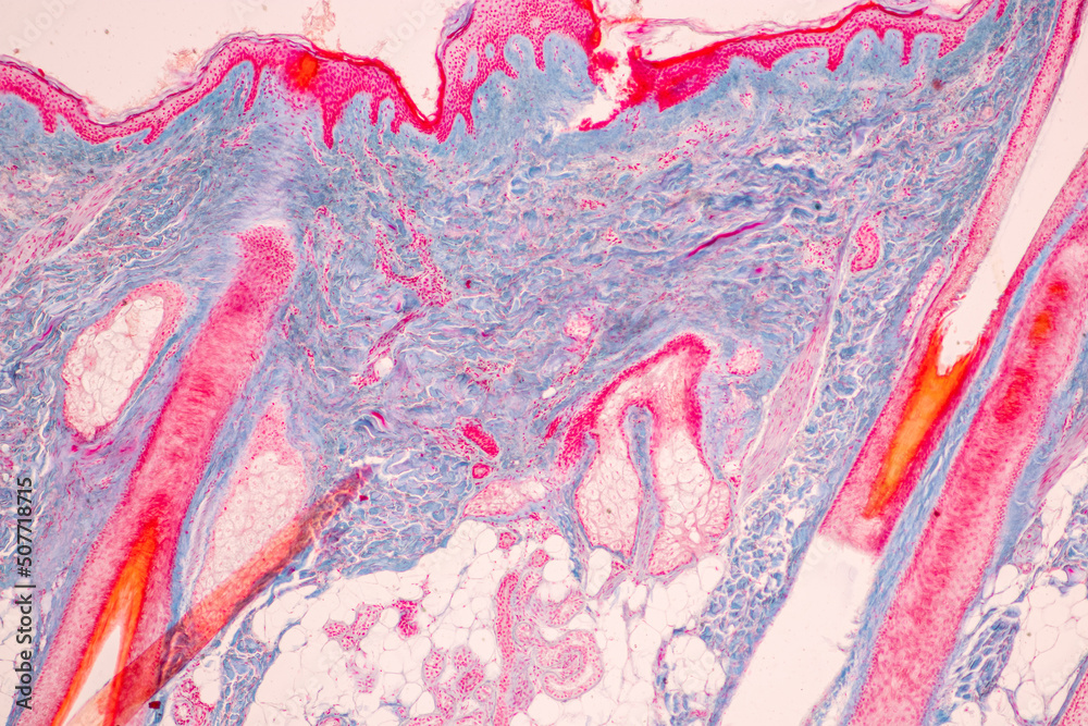 Scalp and hair follicles of human under the microscope in Lab. Stock ...