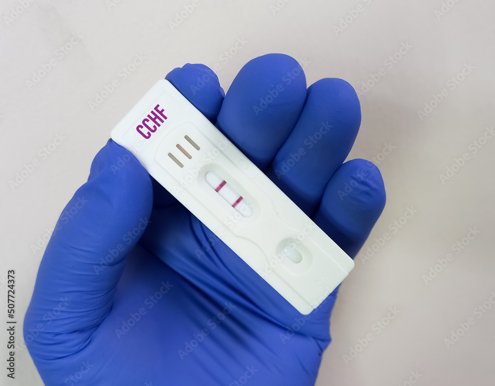 Rapid test device or cassette for Crimean-Congo hemorrhagic fever(CCHF ...